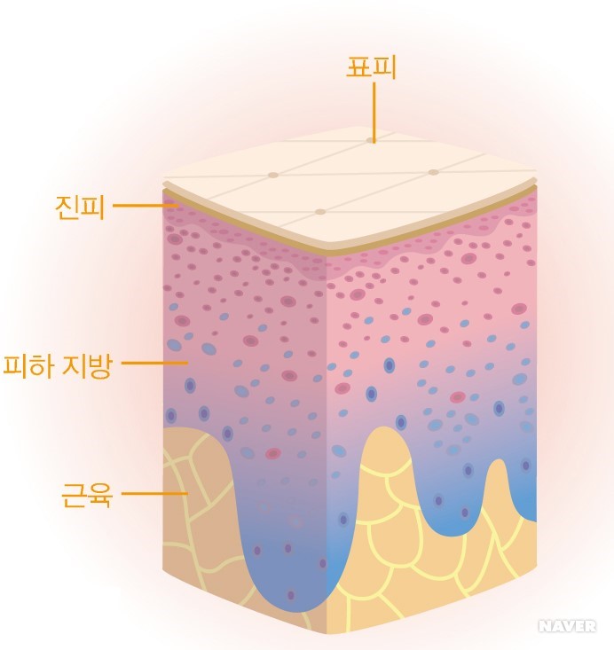 상해수술비 창상봉합술 분쟁조정사례 정리 Feat 일차봉합술변연절제술근봉합술 네이버 블로그